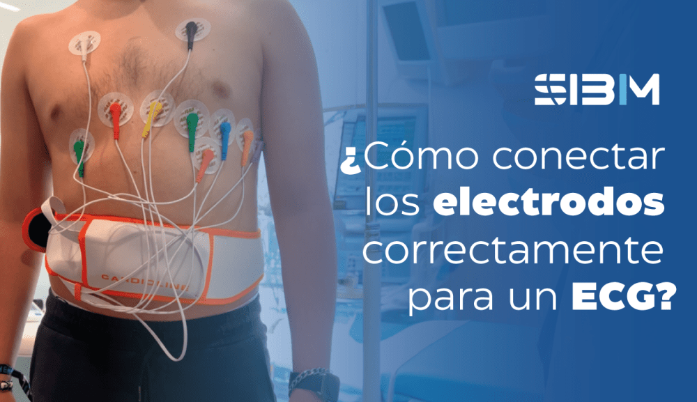 ¿Cómo conectar los electrodos correctamente para un ECG? - SIBIM